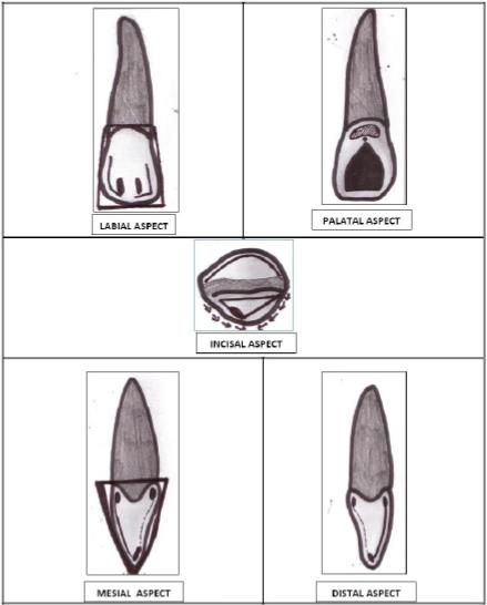 Permanent maxillary lateral incisors l tooth crown & root morphology ...