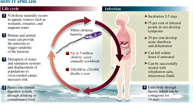 Cholera: Signs and Symptoms Of Cholera - Medical Yukti