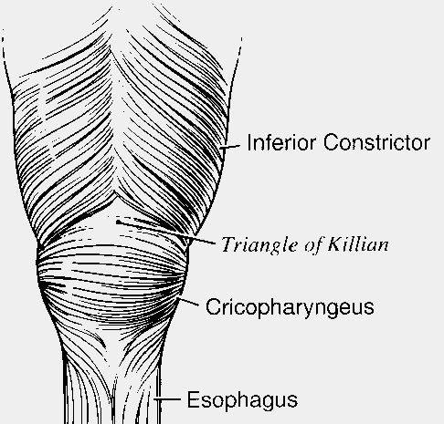 icupearls.org Archive: Killian's triangle
