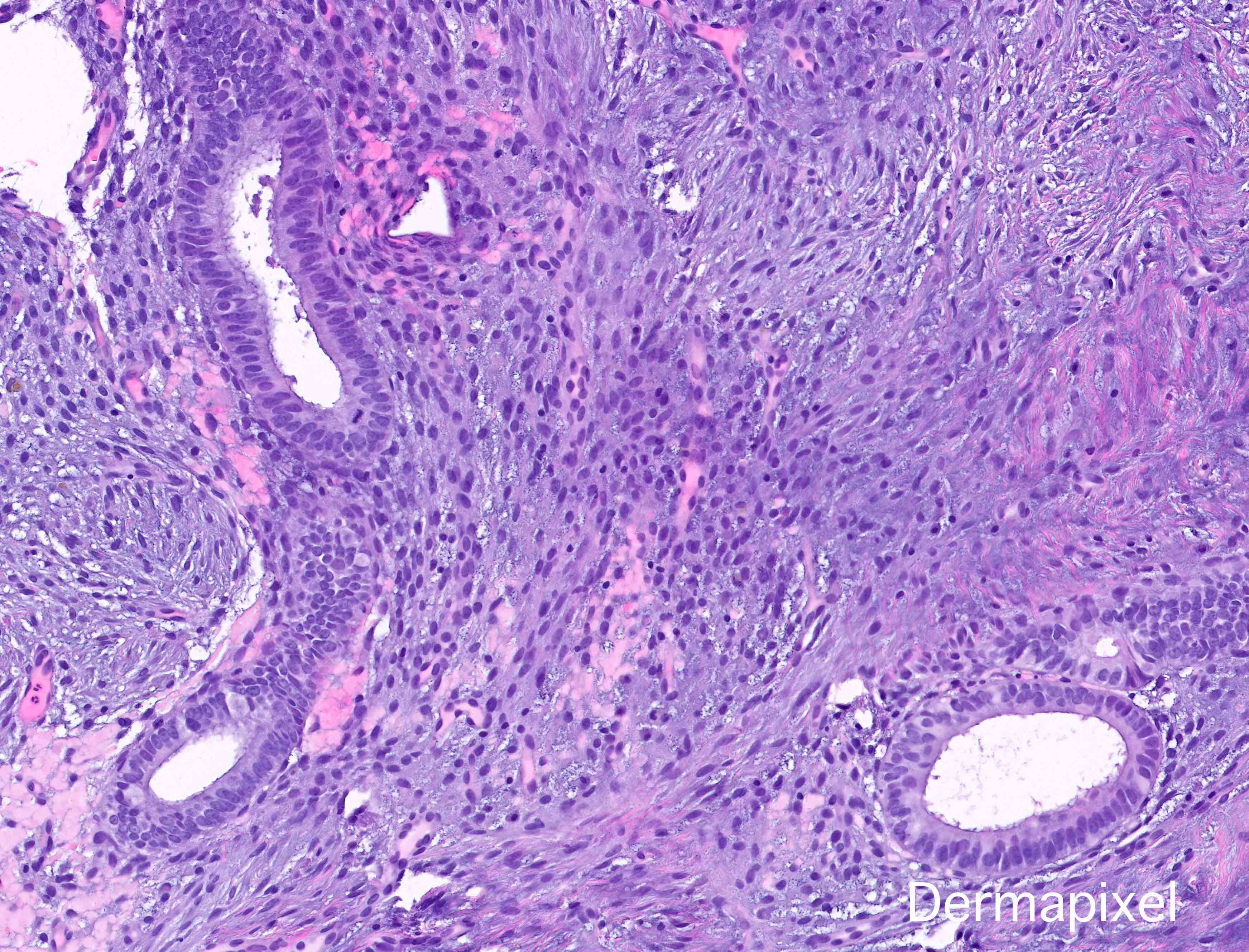 Dermapixel: abril 2021