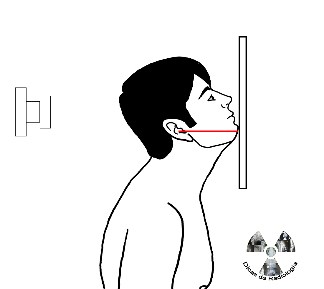 DICAS DE RADIOLOGIA: POSICIONAMENTO RAIO-X DE SEIOS DA FACE PA - MENTONASO
