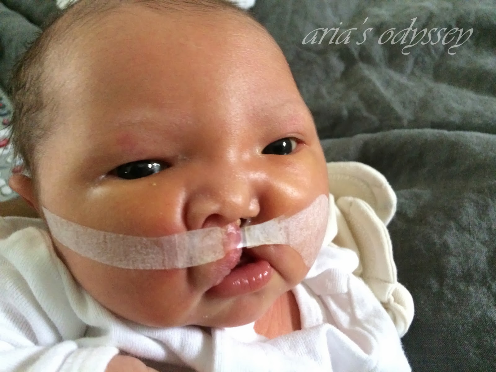 Aria's Odyssey: Molding