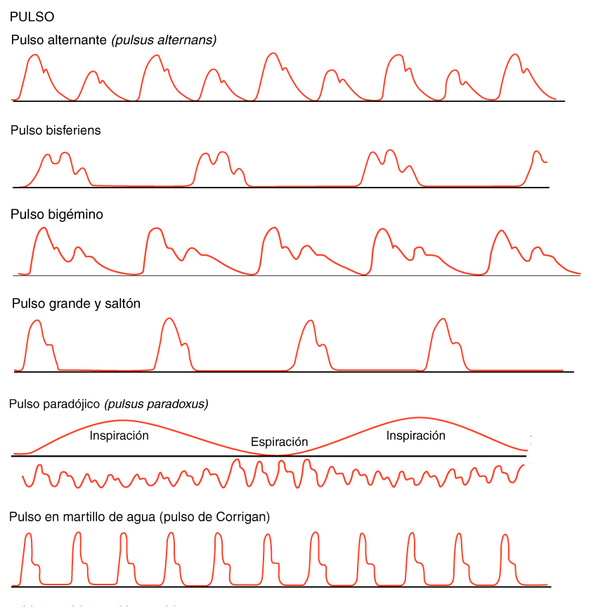 EMS SOLUTIONS INTERNATIONAL by @DrRamonReyesMD marca registrada: Pulso ...