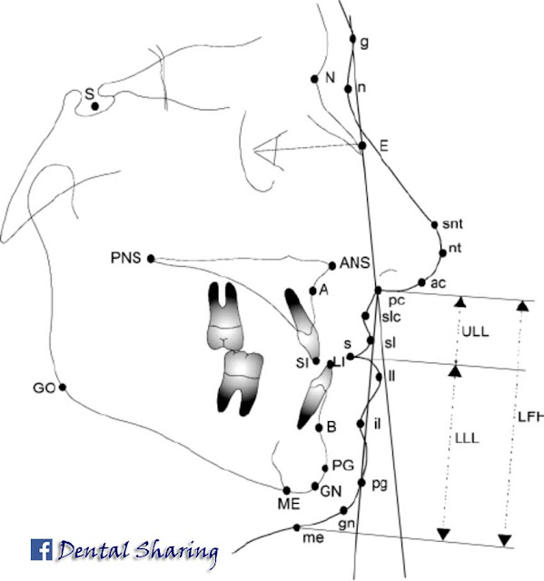 PHÂN TÍNH PHIM CEPHALOMETRIC_P1 - Dr. Răng Hàm Nhỏ