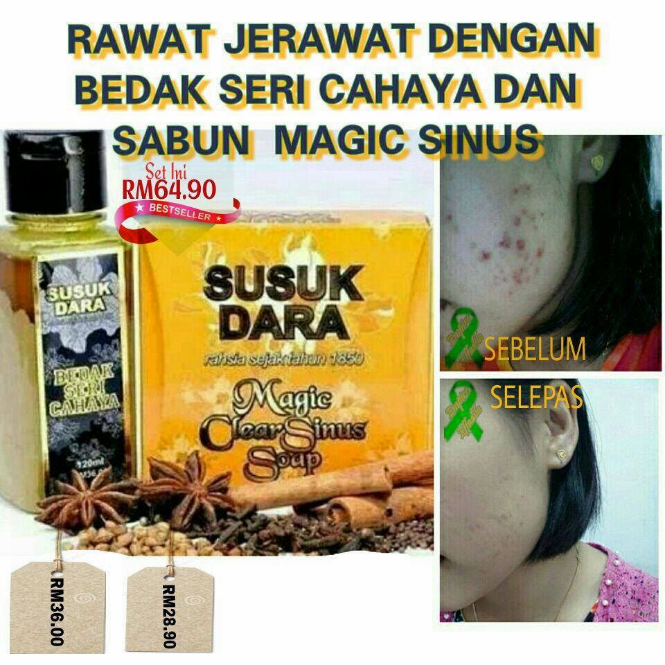 JAMU SUSUK DARA: RESDUNG DAN RAWATANNYA