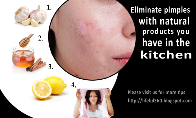 4 Healthy and Natural Ways to Get Rid of Pimples | Life in Bangladesh
