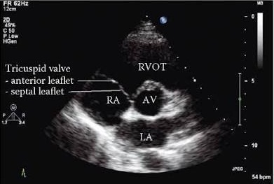 Learn Echocardiography | Standard Protocol for Performing Comprehensive ...