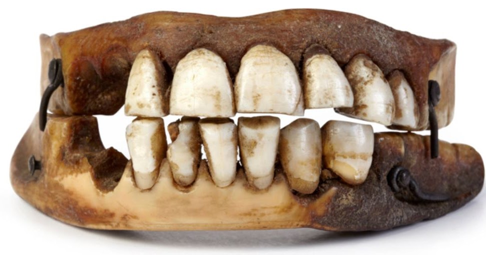 Many of the Dentures in the 18th and 19th Centuries Were Made From the ...