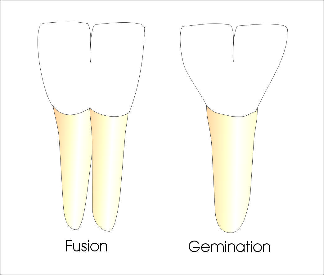 Estomatologia Online: Anomalias Dentárias