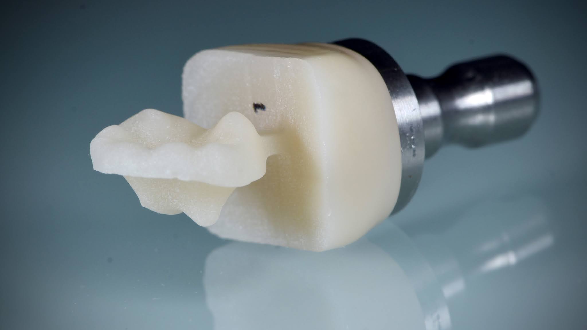 Endocrown .. Full documentation of a clinical case | Dental Esthetics