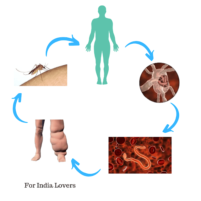 Lymphatic Filariasis - For India Lovers