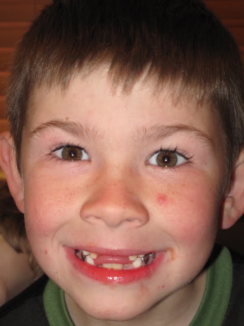 Boys "R" Us: From Snaggletooth to Toothless