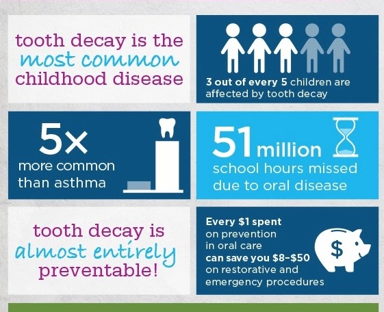 Prevention of Early Childhood caries: Importance of prevention of Caries
