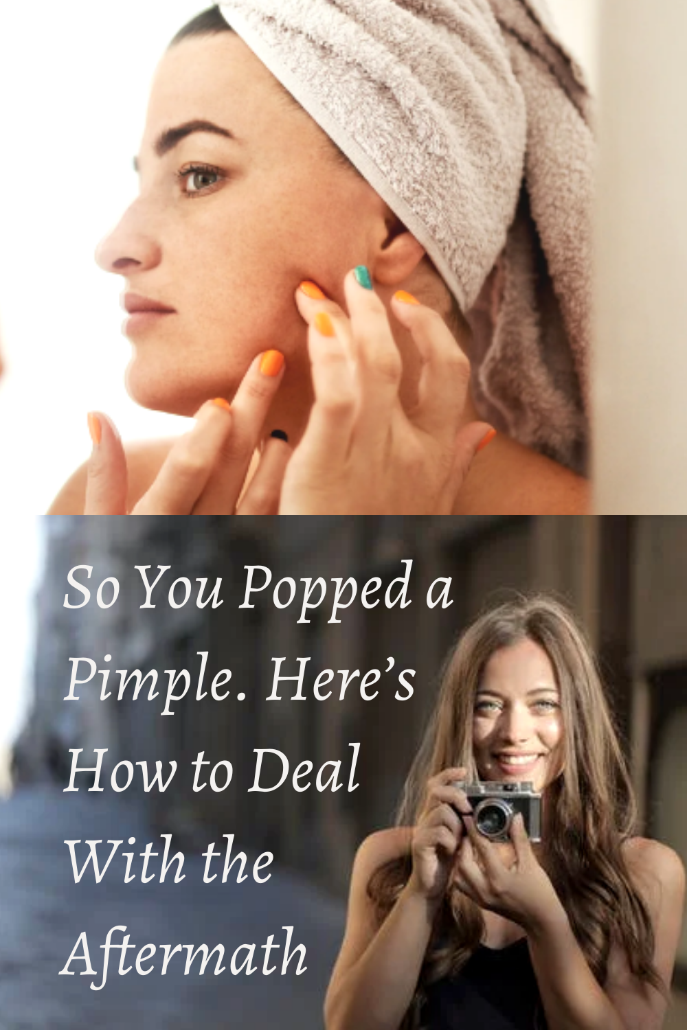 So You Popped a Pimple. Here’s How to Deal With the Aftermath