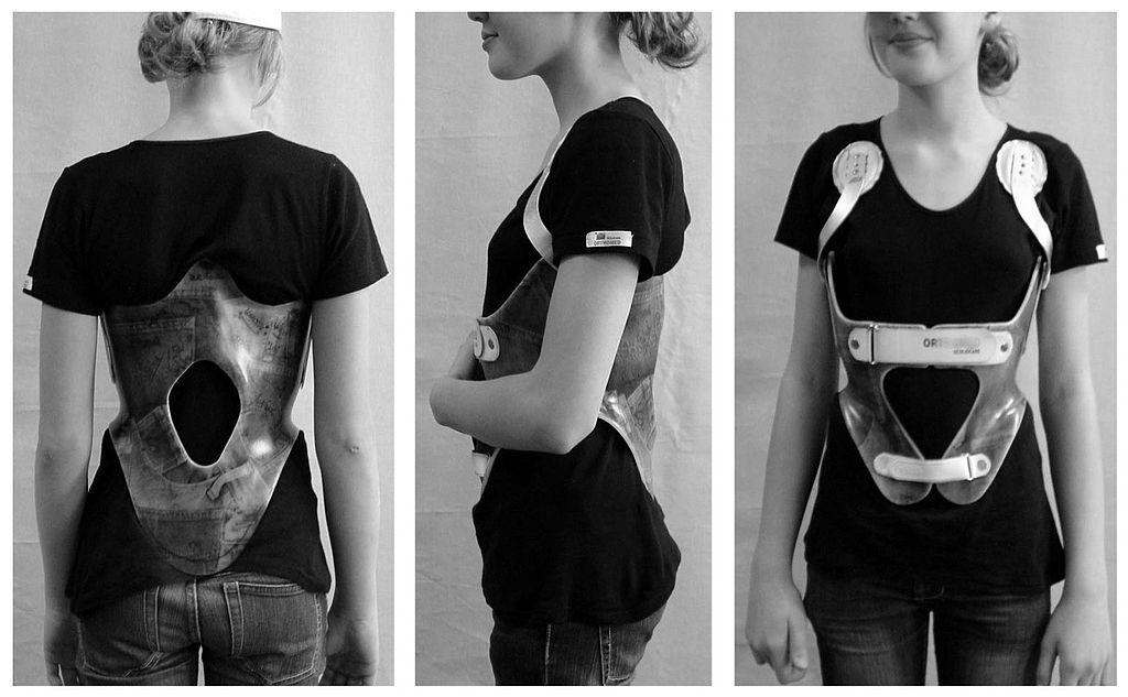 MASTERFISIO: CIFOSIS POSTURAL