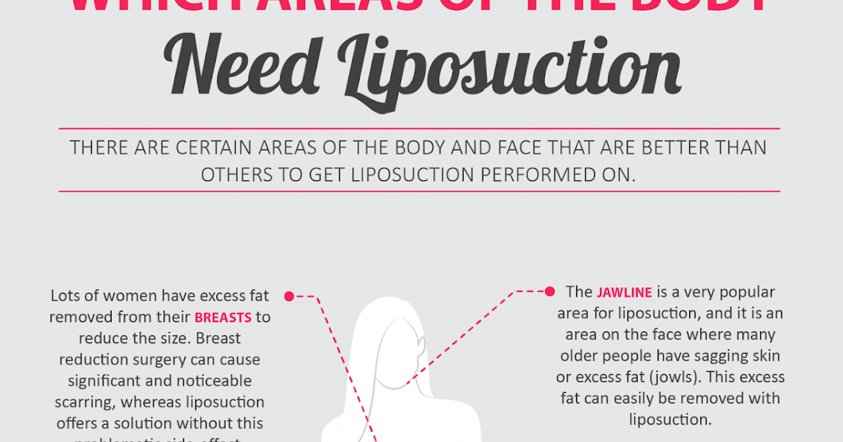 Best areas of your body to have liposuction