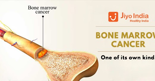 Bone Marrow Cancer: Symptoms, Treatment, Causes, and More