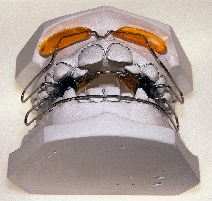 Ortopedia Funcional de los Maxilares: …APRÉNDELO TODO SOBRE EL APARATO ...