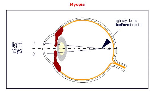 Human Eye Diagram And Anatomy Complete With Images | Safe Health Tips