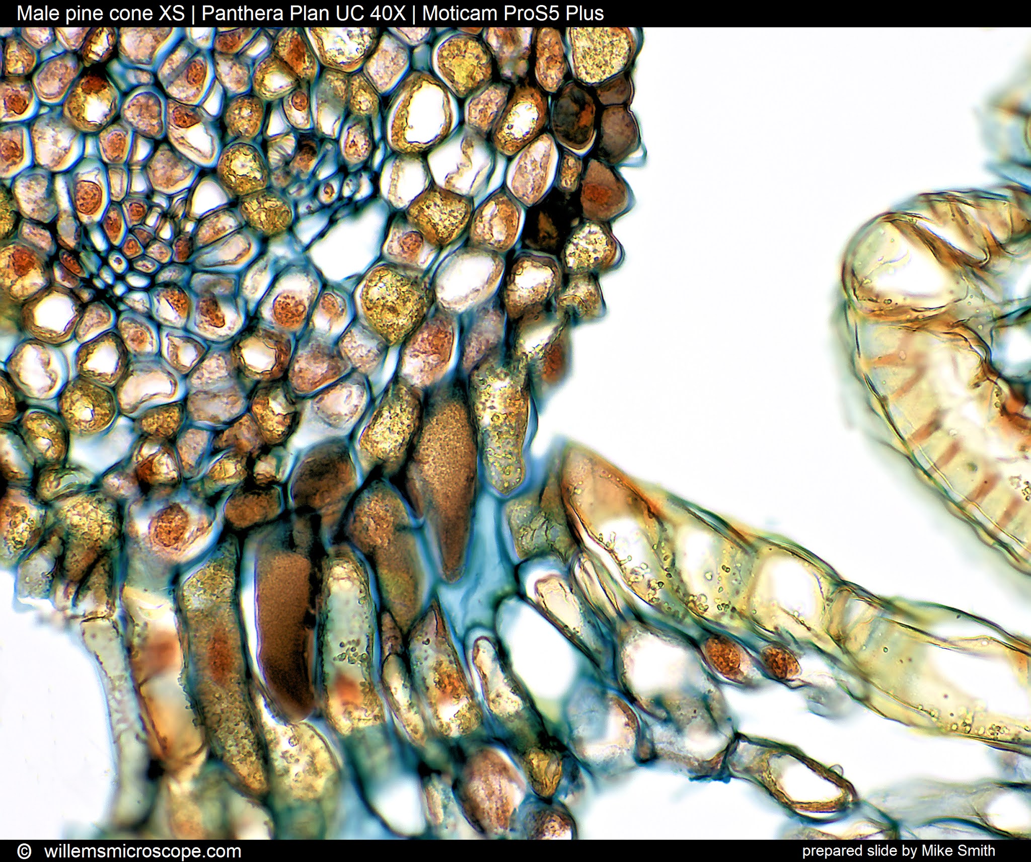 Female Pine Cone Microscope