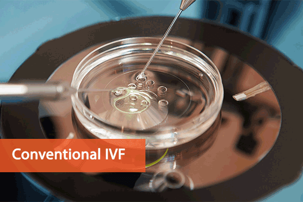 Life IVF Center: Let’s understand what Conventional IVF Treatment is ...