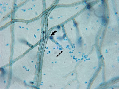 Fun With Microbiology (What's Buggin' You?): Pleruostomophora richardsiae