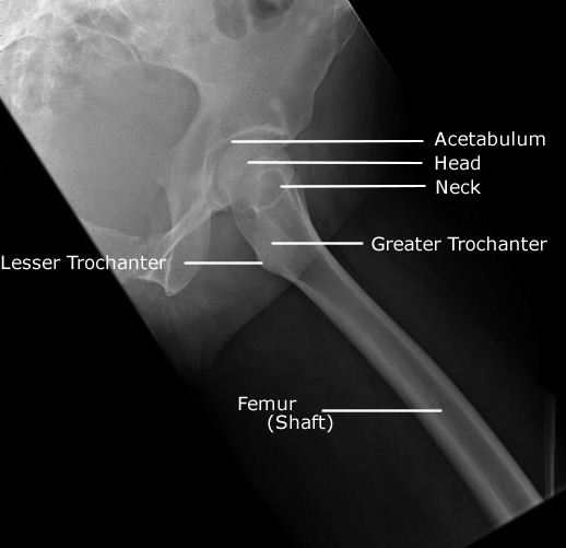 Radiographic positioning: LOWER LIMB