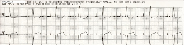 EKG Rhythm Strips 22: Paced Rhythms