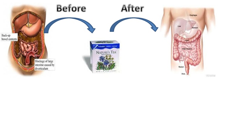 BIOLIFE - SLIM (Make life better)