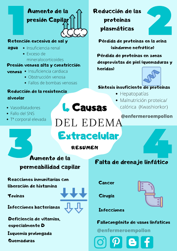 Las 4 causas del edema extracelular (resumen)