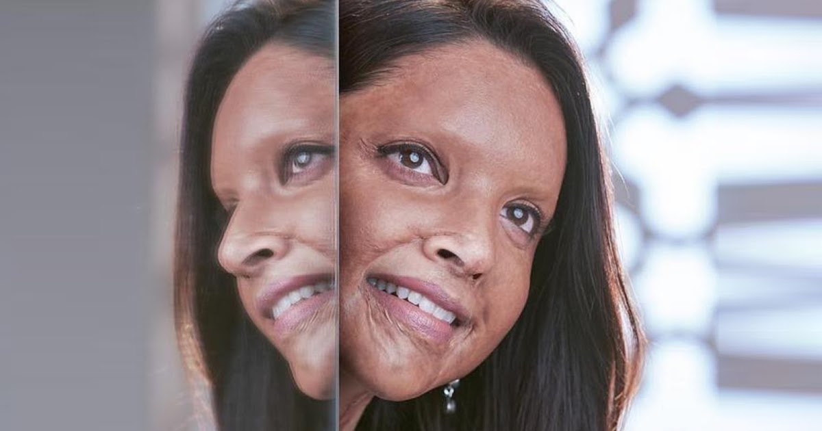 Chhapak Deepika Padukone Full Movie Story and Review - Latest Trending News