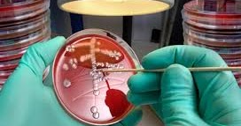 Listeria Infection (Listeriosis) Symptoms, Causes & Treatment ...