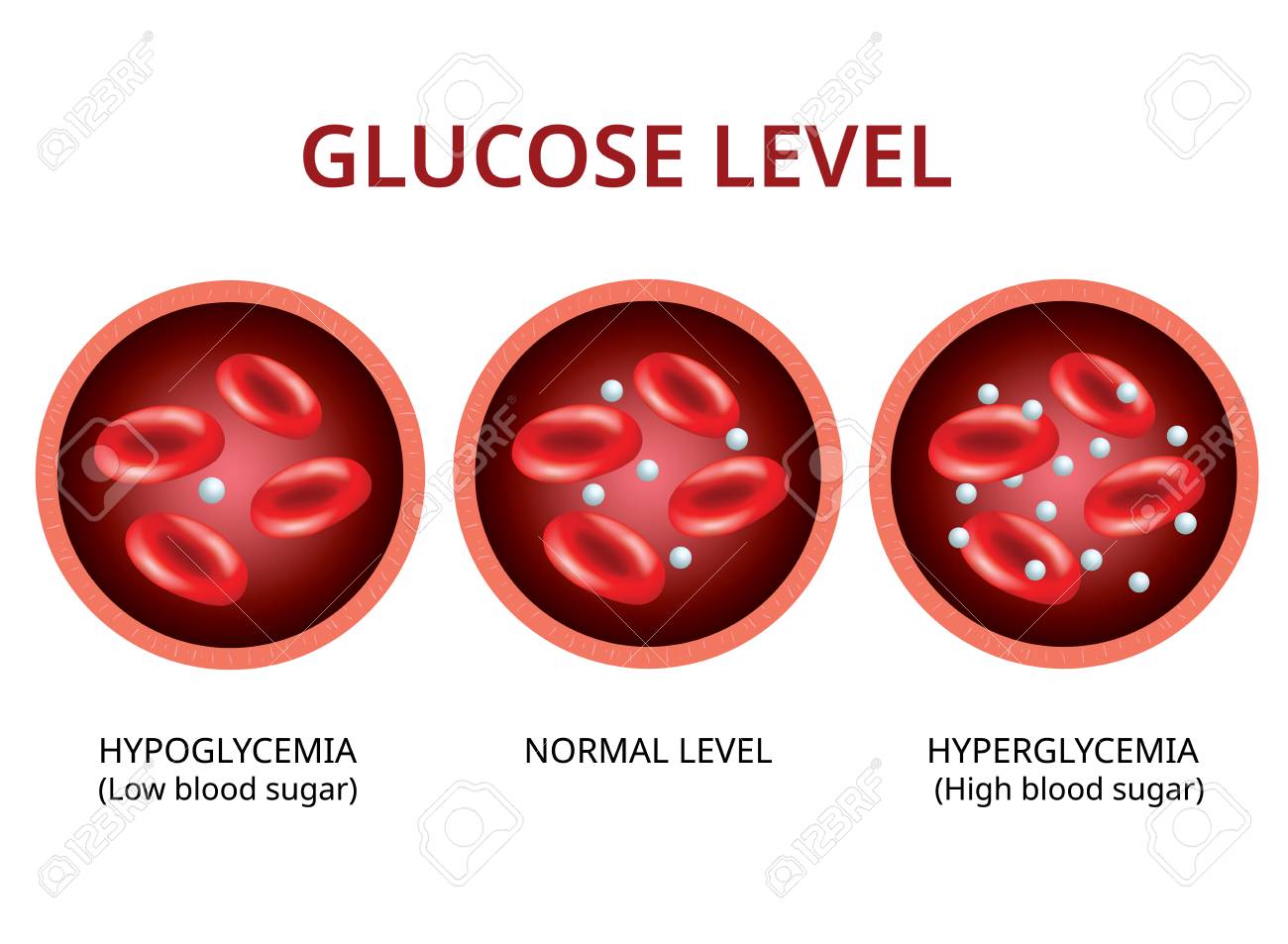 Diabetes: Symptoms, Treatment, Prevention and early Diagnosis