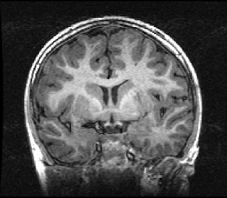 The Playful Spirit: Functional MRI... cool brain mapping!