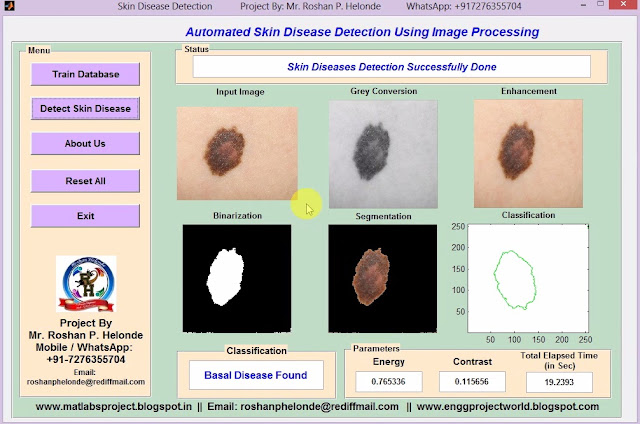Skin Disease Detection Using Image Processing Matlab Project Code Ieee