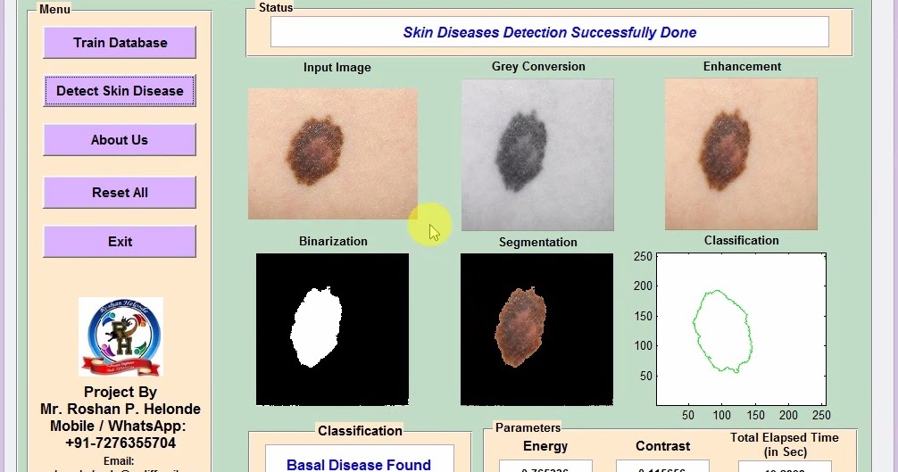 Skin Disease Detection Using Image Processing Matlab Project Code IEEE ...