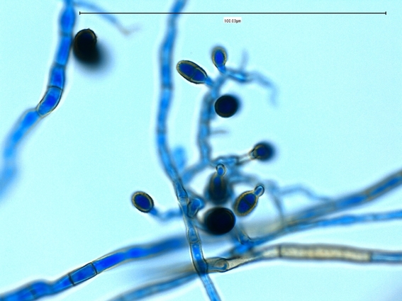 Fun With Microbiology (What's Buggin' You?): Pithomyces species
