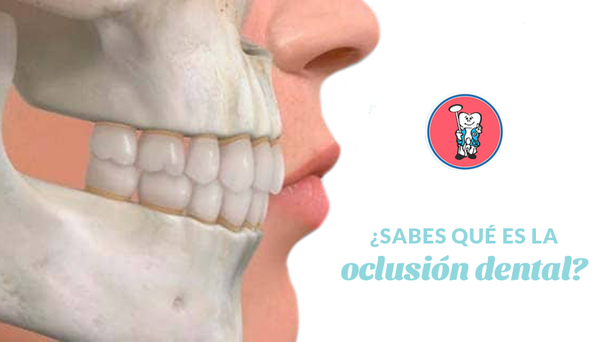 ¿Qué es la oclusión dental?