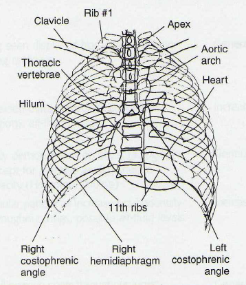 Teknik Pemeriksaan Radiografi Thorax Proyeksi PA - Seputar Kesehatan