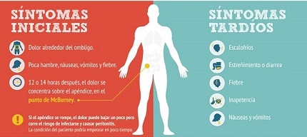 Apendicitis - Generalidades