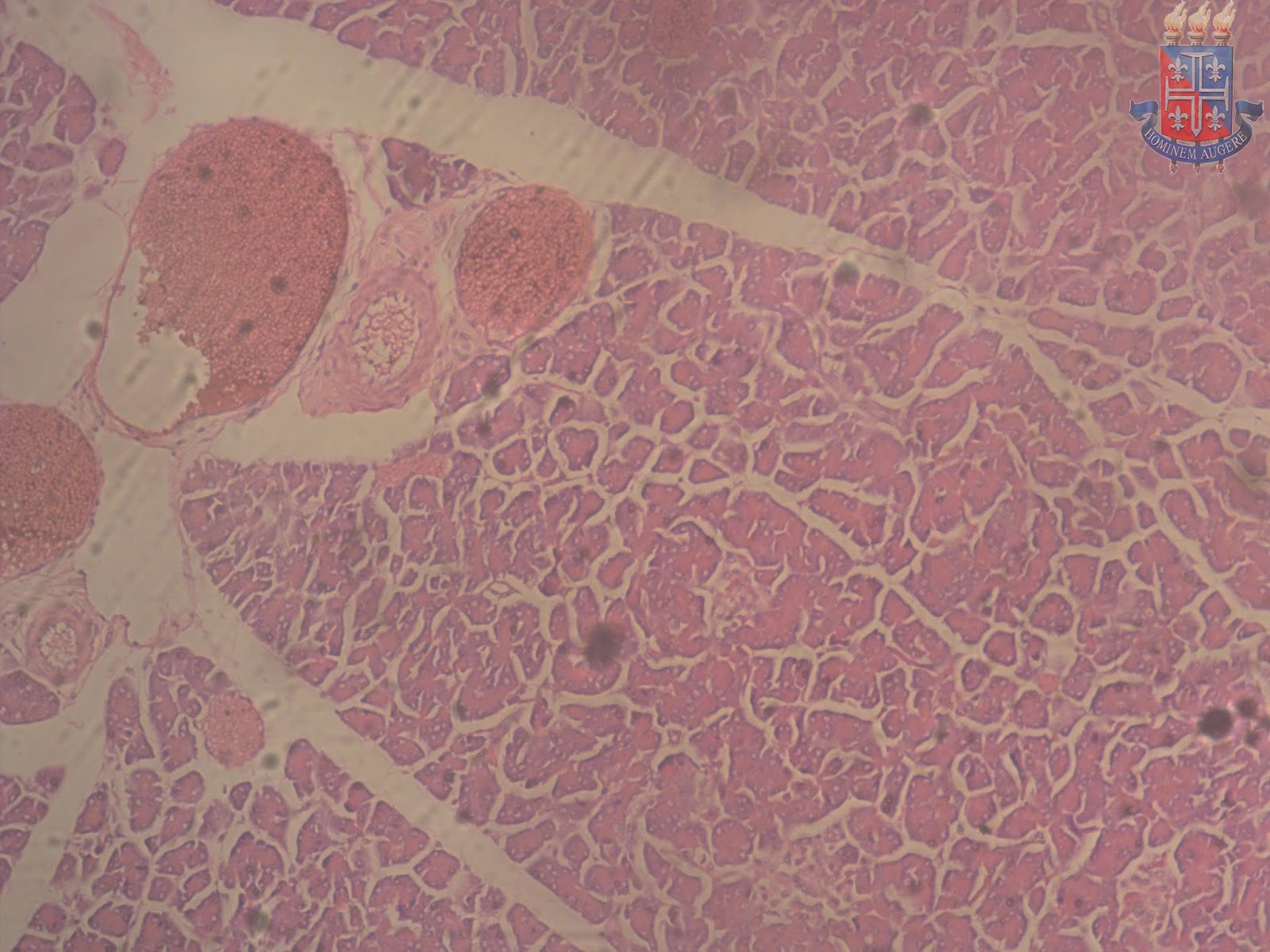 Atlas virtual de histologia e patologia: Pâncreas