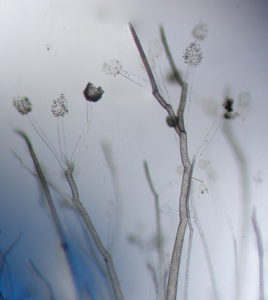 Saprolegniaceae – Variety of Life