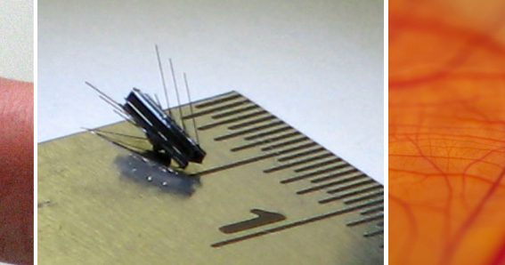 SurgRob: ViRob - an Autonomous Crawling Micro-Robot
