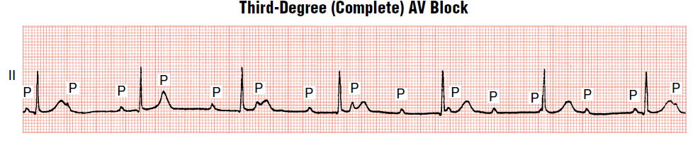 NOTA KEDOKTERAN: Interpretation of ECG (Introduction, Chambers ...