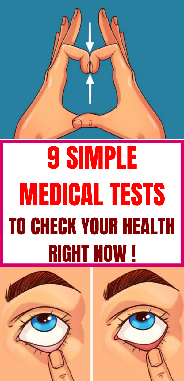 9 Simple Medical Tests to Check Your Health Right Now ! | passionofswathi