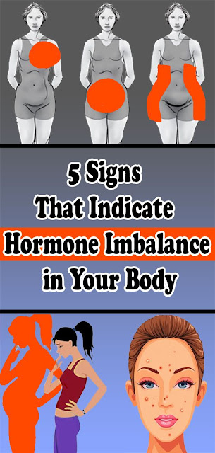 5 Signs That Indicate Hormone Imbalance In Your Body Medicine Health Life