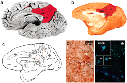 Al Fin: Posteromedial Cortex: Pathway to the Self?