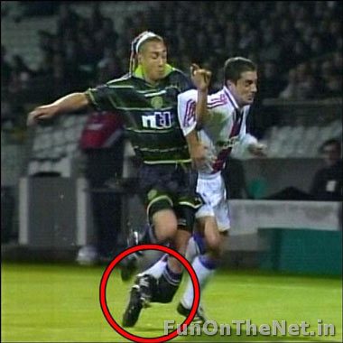 Blog FUAD - Informasi Dikongsi Bersama: 6 Worst Soccer Injuries