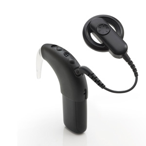 Cochlear Implant Technology and Services: Advances in Cochlear Implant ...