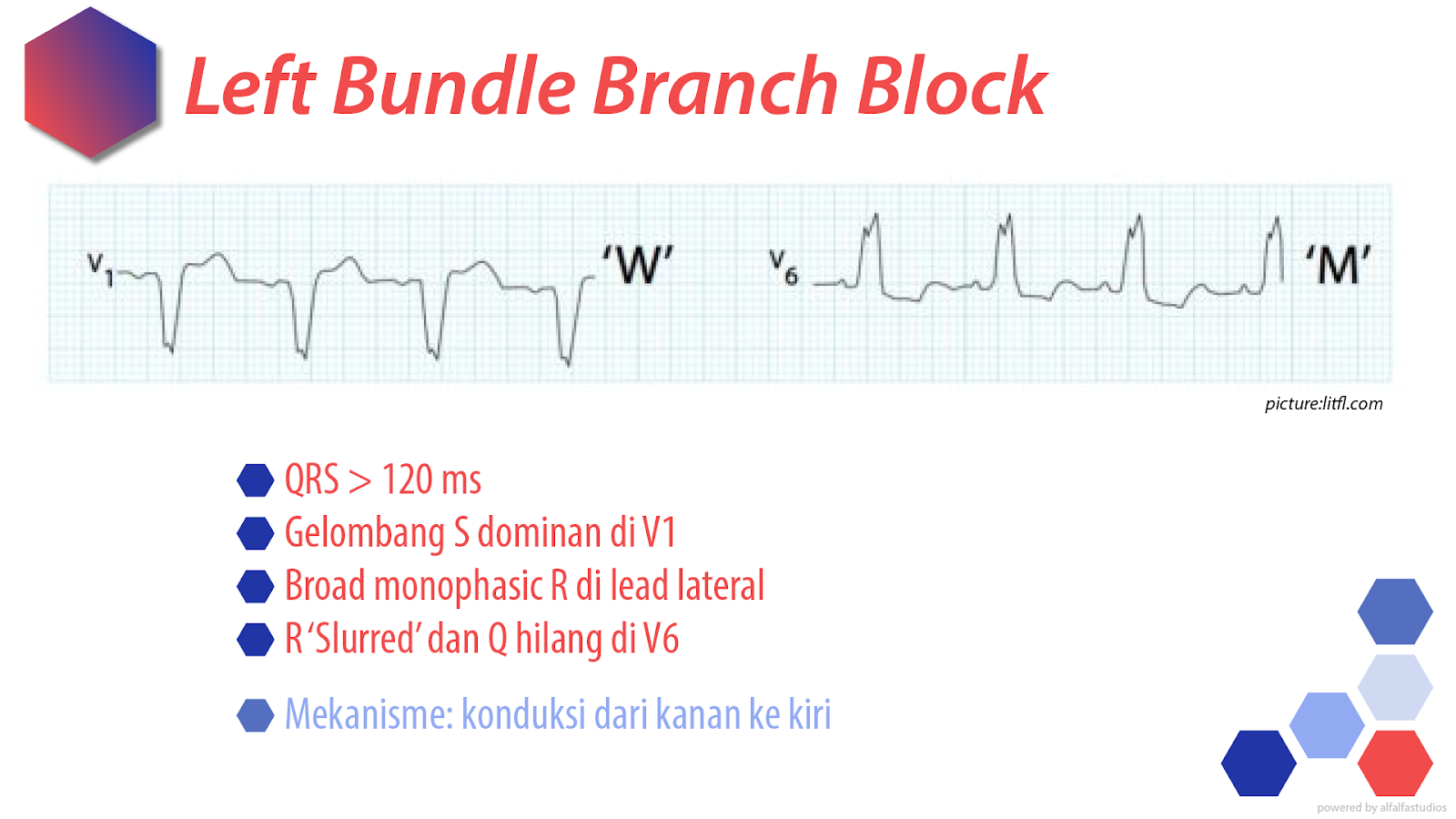 Conduction Block; AV Block & Bundle Branch Block; Workshop EKG | Dokter ...